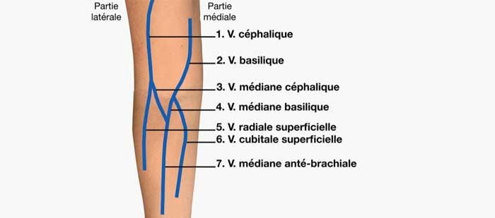 La voie d’abord périphérique intraveineuse (VVP) - Perfusion à domicile